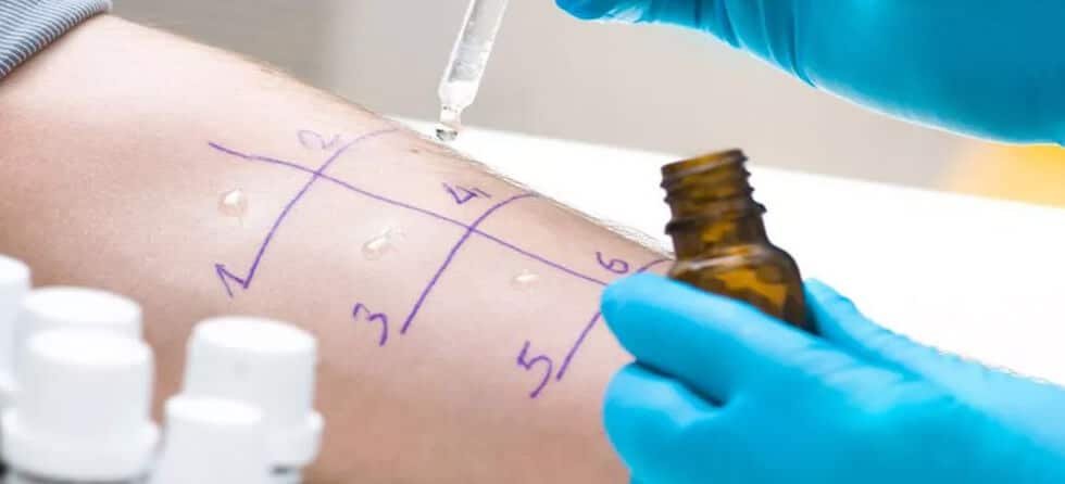 What are Detectable Allergies? – Molecular Allergy Test