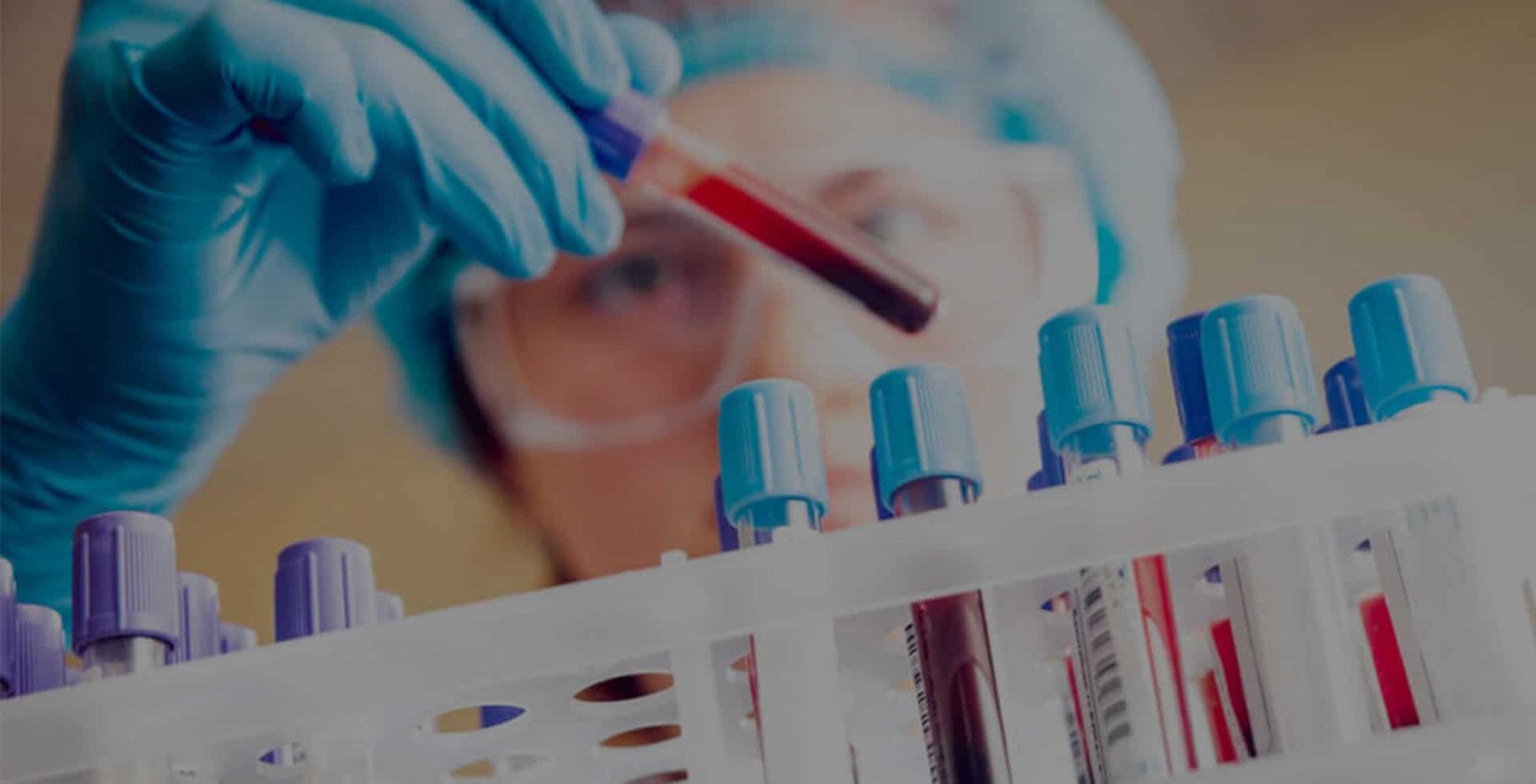 What is Molecular Allergy Test? – Molecular Allergy Test